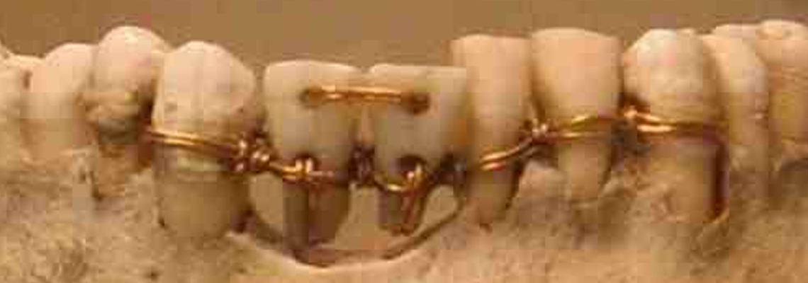 Dental Health in Ancient Civilizations | Best Dental Clinic in Hyderabad